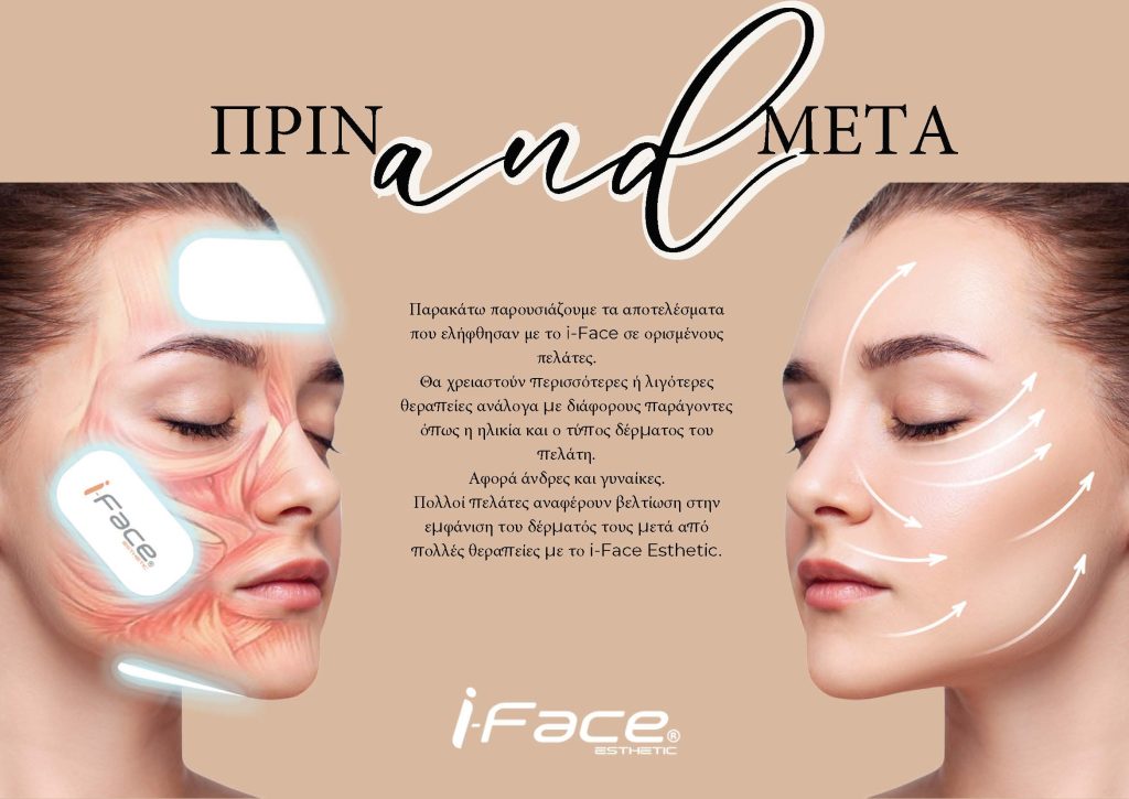 i-Face | Velobien